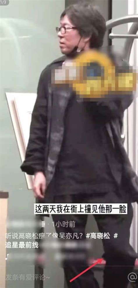 高晓松暴瘦26斤后现身街头，脸部松垮气色差，被指减肥后脱发严重腾讯新闻