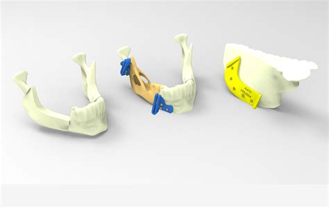 گایدهای جراحی اطلس سلامت