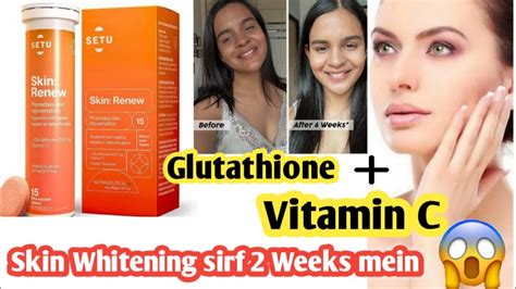 Setu Glutathione Vitamin C Review Honest Review Skin Brightening