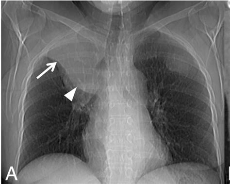 Sthanu On Twitter Sign Pathology