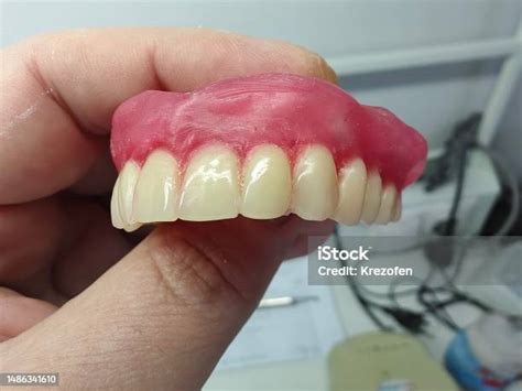 환자를위한 이동식 틀니는 치과 기공소에서 만들어집니다 가득 찬에 대한 스톡 사진 및 기타 이미지 가득 찬 건강 진단 건강