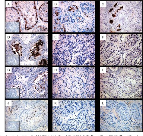 Figure 2 From Long Term Spermatogonial Survival In Cryopreserved And