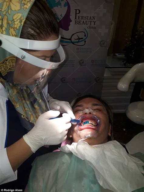 Human Ken Doll Rodrigo Alves Shows Off New Porcelain Teeth Daily Mail
