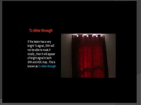 Diffusion Weighted Brain Imaging Ppt