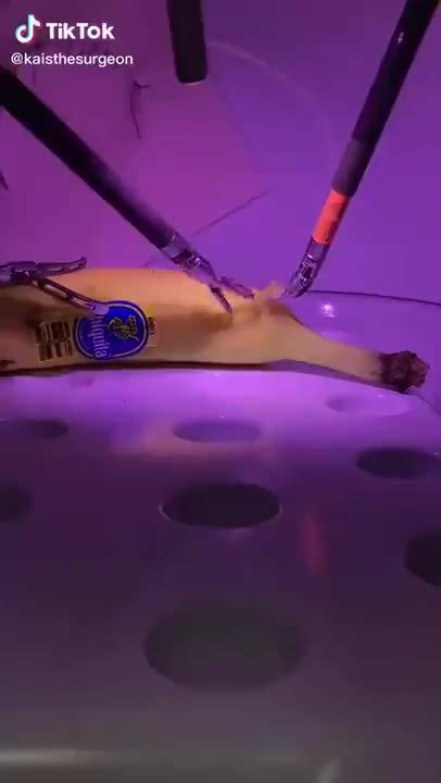 Mahmood Ahmed On Linkedin 5g Use Case In The Medical Sector