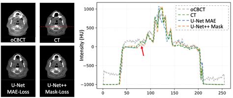 Nimus Paper On Head And Neck Synthetic Ct Generated From Ultra Low Dose Cone Beam Ct Following