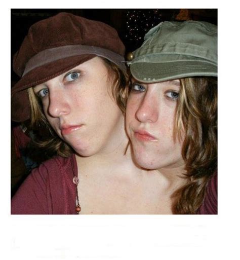 ყველაზე უჩვეულო სიამის ტყუპები ფოტოები