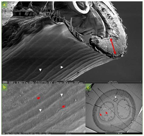 Worm Morphology Under Se And Te Microscopy A Cross Sectional Tissue
