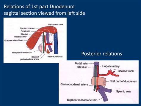 Anatomy Of Duodenum Duodenum Structure Ppt Of Duodenum Power Point