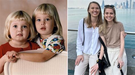 Twin Sisters Face Rare Disease Plus Dentists Reveal Oral Care Secrets