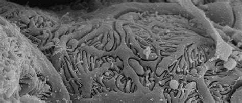 About Electron Microscopy