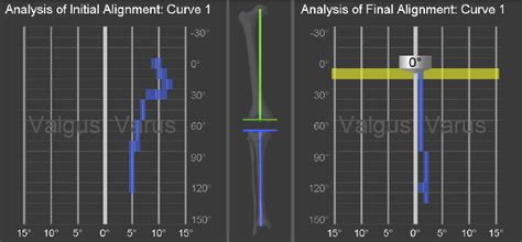 Figure 2 From Computer Assisted Navigation In Total Knee And Hip