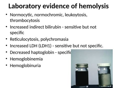 Anemia Classification Basic Lab Diagnosis Pptx