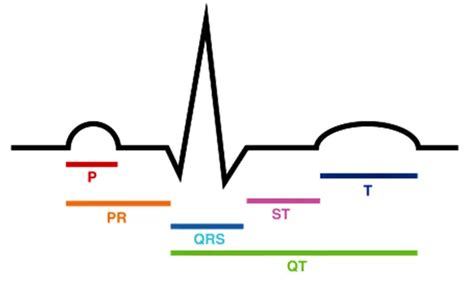 Electrocardiogram How Ecg Works Components Of Ecg