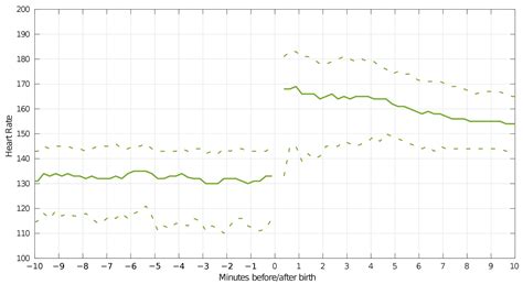 Fetal To Neonatal Heart Rate Transition During Normal Vaginal Deliveries A Prospective