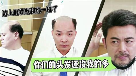 男人假发男士高端假发拯救了多少秃头焦虑的兄弟 时尚 化妆 好看视频