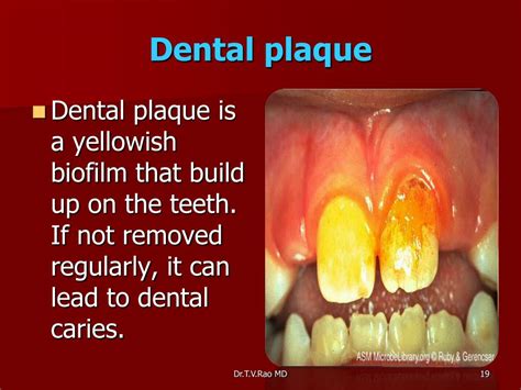 Ppt Biofilms In Infection Powerpoint Presentation Free Download Id
