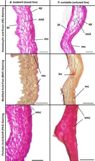 The Epithelial Layer Of The B Boddarti Fused Pelvic Fins And P Download Scientific Diagram