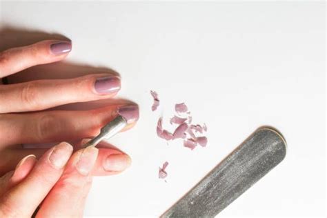 Why Do I Get White Stuff Under My Nails When I Scratch Head Igxo
