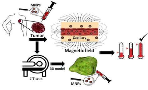 Numerical Simulation Of Magnetic Nanoparticle Hyperthermia For Cancer Treatment ESB