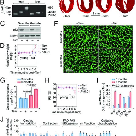 Heart Specific Ablation Of P53 Triggers Age Dependent Concentric