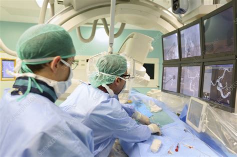 Cerebral Aneurysm Embolisation Surgery Stock Image C061 1313 Science Photo Library