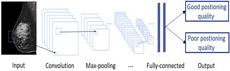 Cancers Free Full Text Automated Assessment Of Breast Positioning