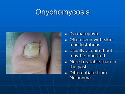 Diagnosis And Treatment Of Common Foot Conditions Ppt Video Online