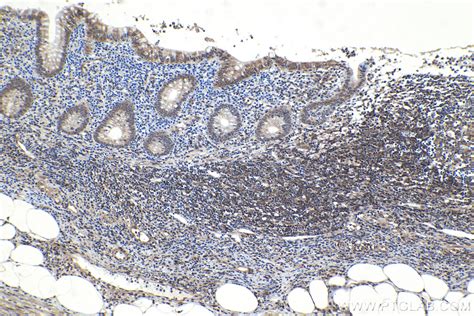 Ihceasy Stat6 Ready To Use Ihc Kit Khc1151 Proteintech 武汉三鹰生物技术有限公司