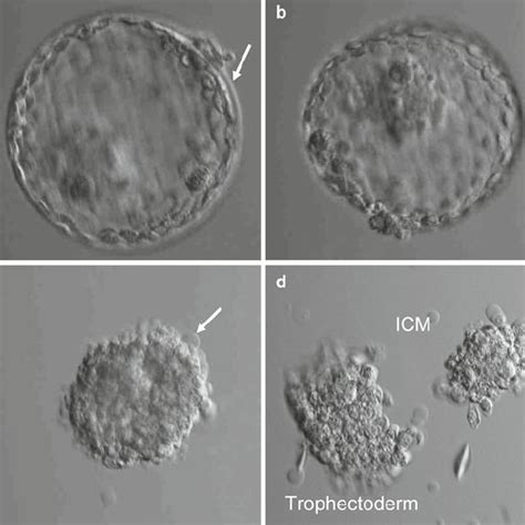Immunosurgery Procedure A Expanded Day 6 Blastocyst The Arrow