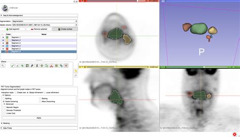 Documentation 4 10 Modules PETTumorSegmentEditorEffect Slicer Wiki