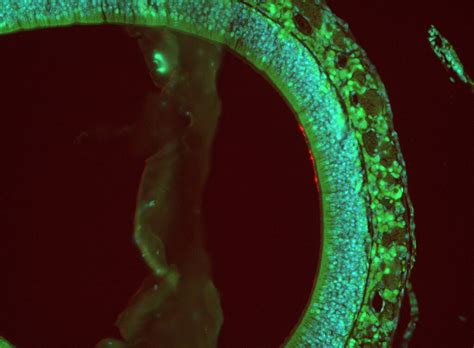 Quantification Of Fluorescence Image Analysis Image Sc Forum