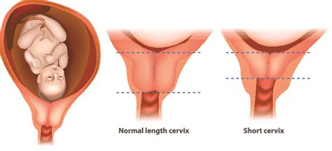Cervix During Pregnancy Week By Week