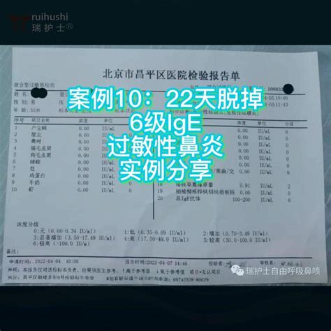 鼻炎鼻窦炎实例集 知乎