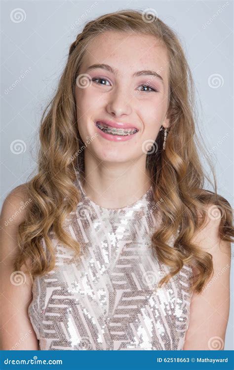 Cute Girls Braces Telegraph
