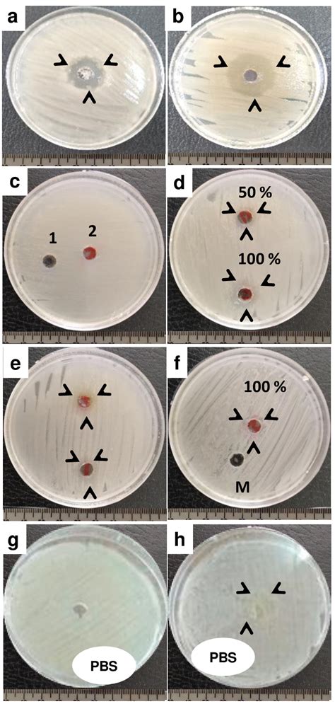 Antibacterial Activity Of The Methanolic And Phosphate Buffer Saline