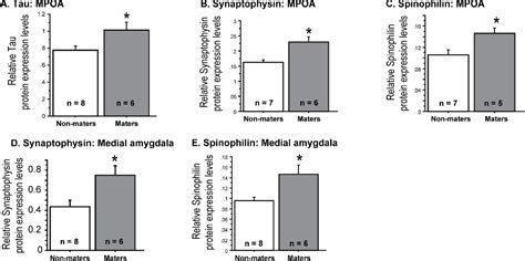 Figure 1 From Increased Dendritic Spine Density And Tau Expression Are
