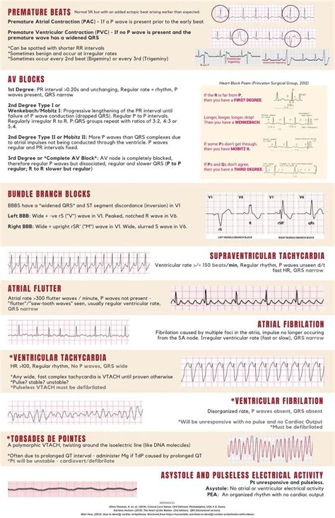Cardiac Dysrhythmias Pdf Electrocardiography Cardiovascular System