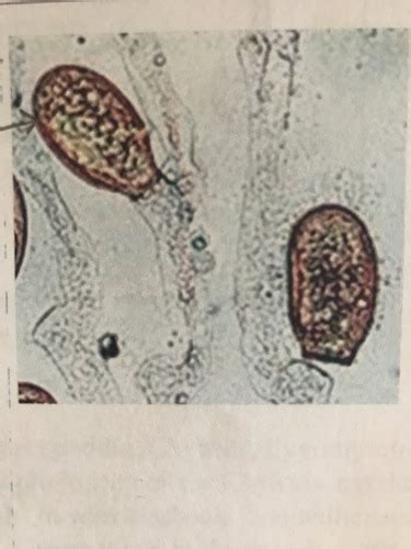 Lab Fungi Practical Flashcards Quizlet