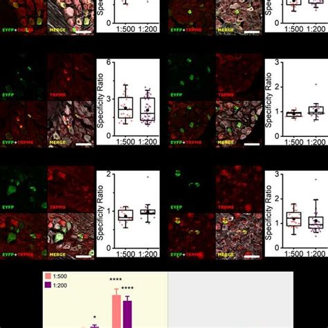 Immunohistochemistry Of Endogenous Trpm8 In Drg Slices From The