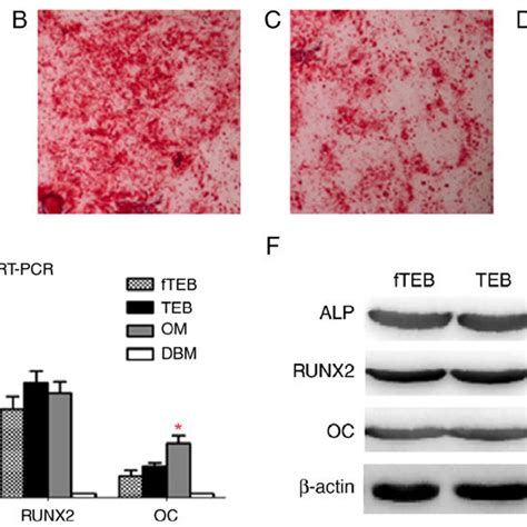 Comparison Of Osteogenic Differentiation Between Hbmscs Treated With