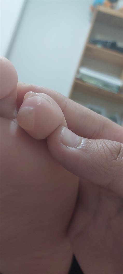 혐오주의어제ㅈㄴ걸으니 국내축구 에펨코리아