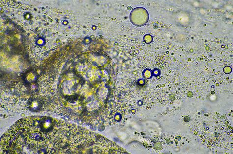 Premium Photo Green Mucus And Coughing Up Phlegm Under The Microscope