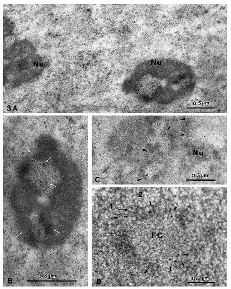Localization Of Ubf By Electron Microscopy A Detection Of Ubf In
