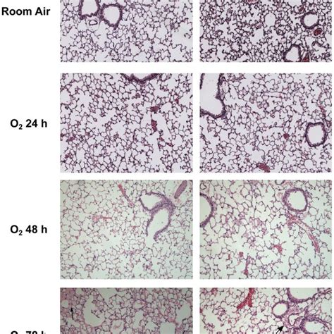 Representative Hematoxylin Eosin Stained Images From The Lungs Of Male