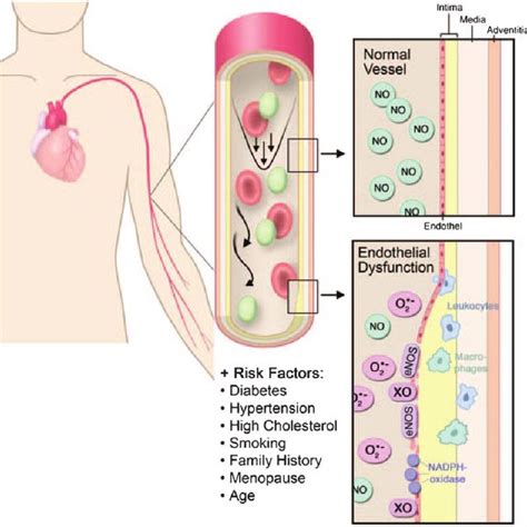 Pdf [endothelial Dysfunction Pathophysiology Diagnosis And Prognosis]