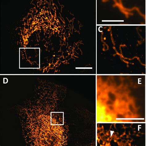 Live Imaging With Popsim A U2os Cells Labeled With Omp Gfp As Imaged