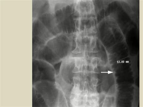 Abdomen And Pelvic Quiz Ppt