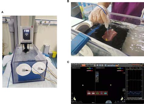 An Ex Vivo Experimental Model A This Model Consisted Of Saline With