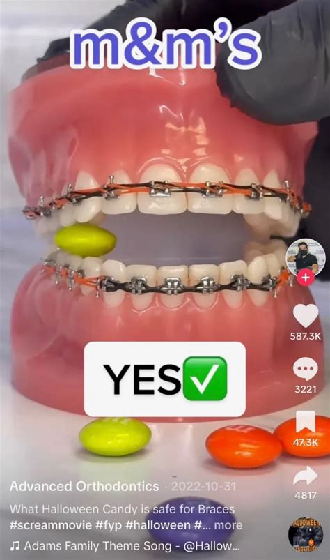 What Halloween Candy Is Safe To Eat With Braces